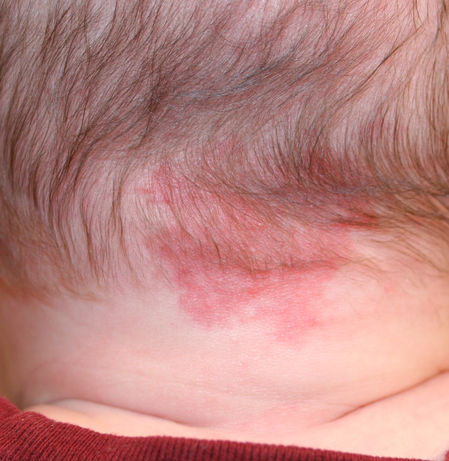 Newborn Physical Characteristics | Playbuzz